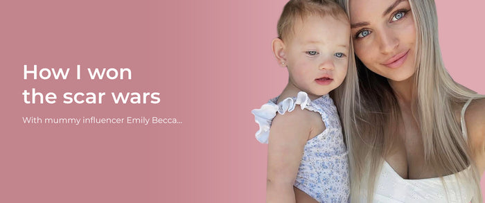 C-Section Scar Stories – Pregnancy & Baby Co
